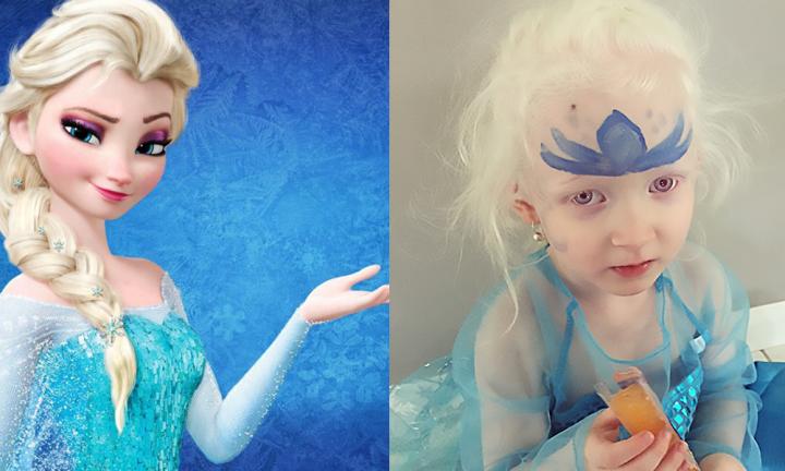 Princesa Elsa ajuda garota a aceitar seu albinismo - Primistili